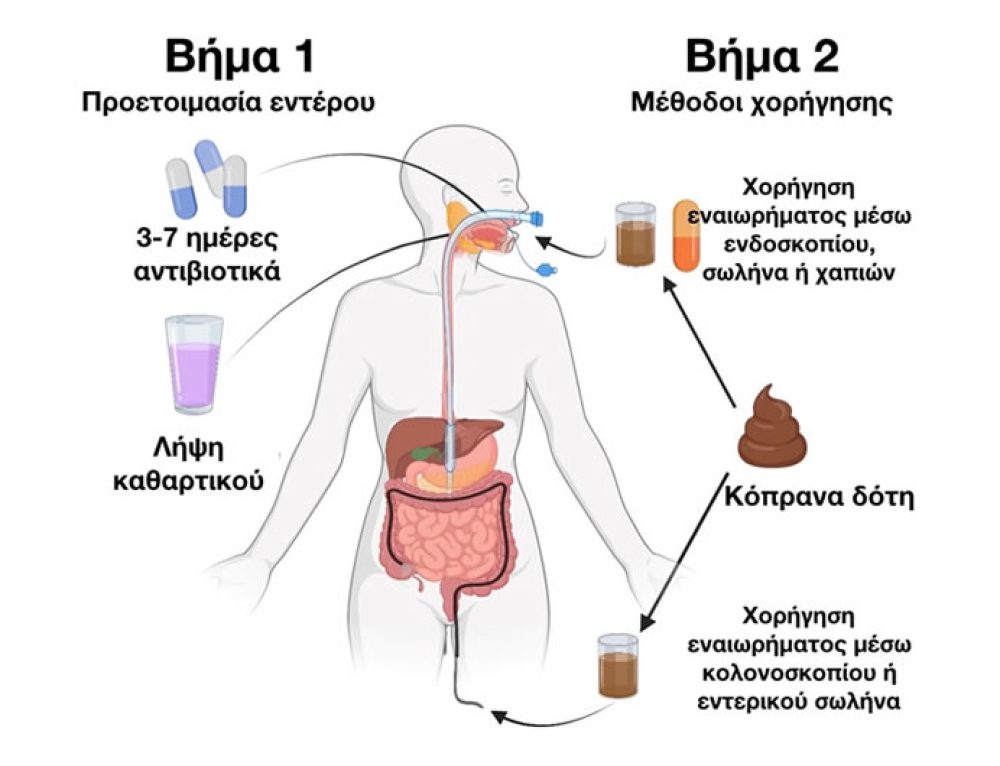 Εβδομαδιαίο Μενού για Ευερέθιστο Έντερο - Athens Gastro